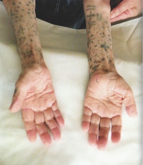 Hajichi – a tatuagem da mulher okinawana – OKINAWANDO